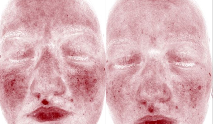 What is the impact of blue light on your skin and how can you protect ...